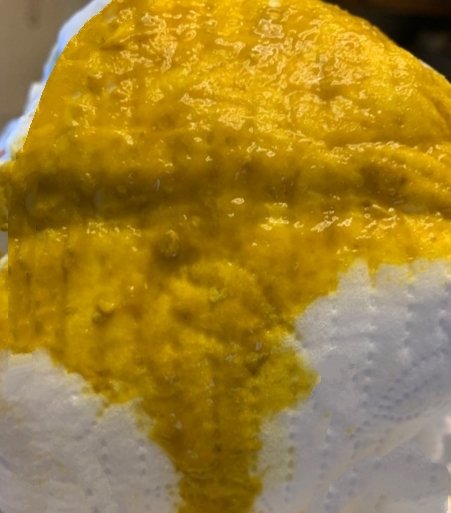 How often should a breastfed baby poop? A guide for parents - Evidence ...